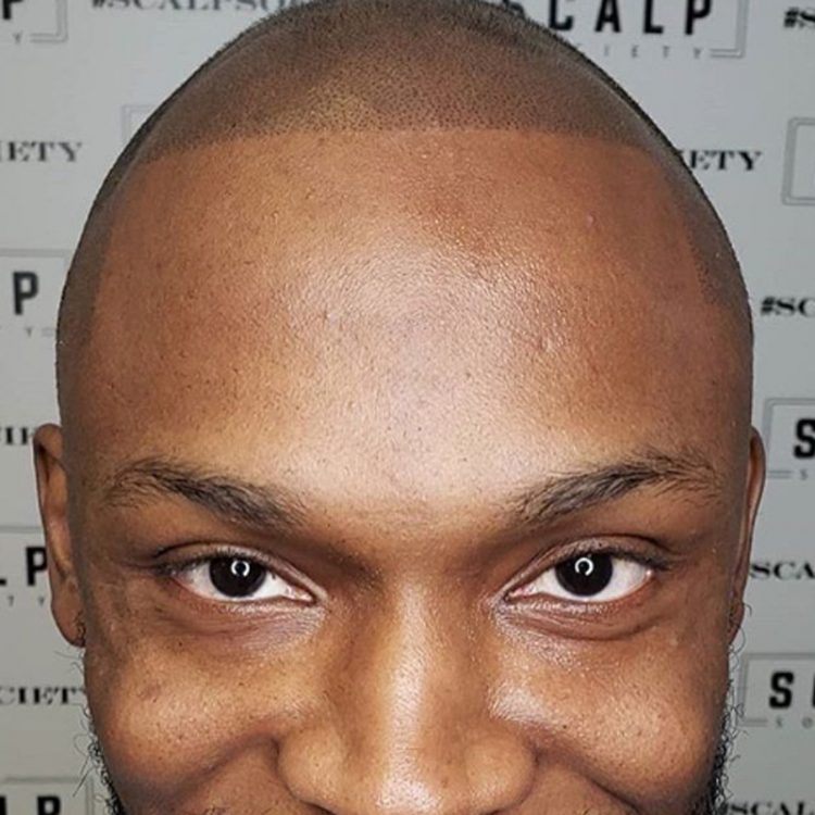 SAN FRANCISCO | Scalp Society